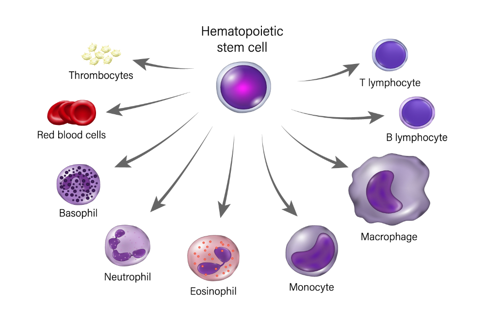 Autologous hematopoietic stem cell transplantation in neuromyelitis ...